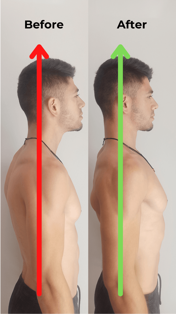 Head and Neck Posture + Mewing – Spartan Health™